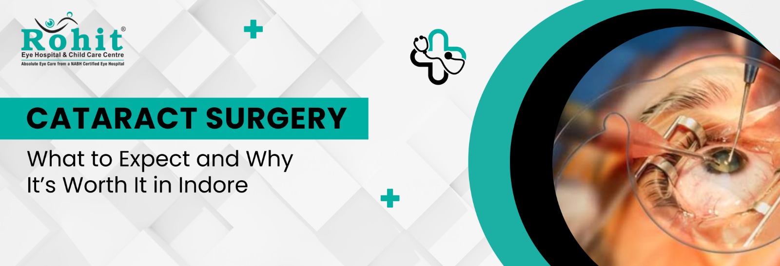 Cataract Surgery: What to Expect and Why It’s Worth It in Indore ...